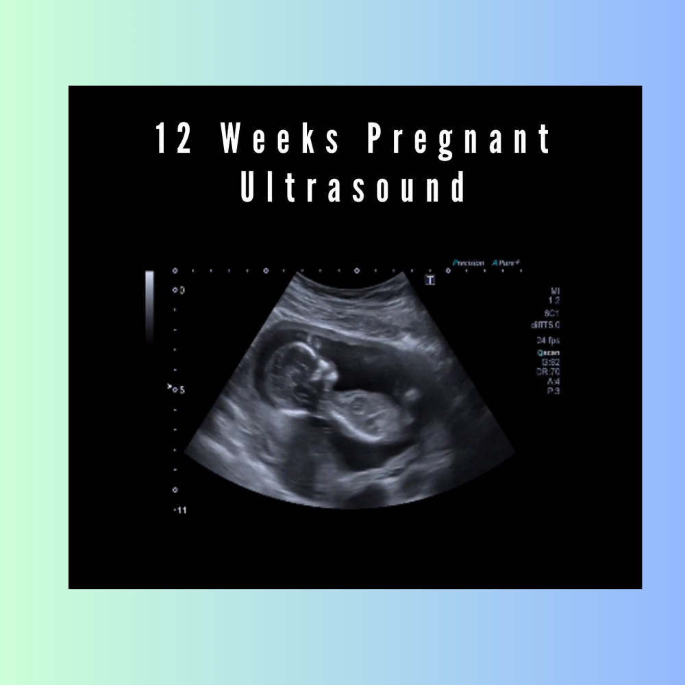 Ultrasounds Blog Posts: From 1-12 Weeks Pregnancy Scan – creetify