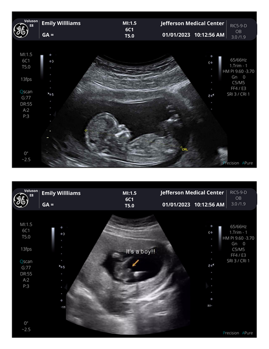 PNG Formats Customizable Digital Ultrasound Downloads | Fake Sonogram ...