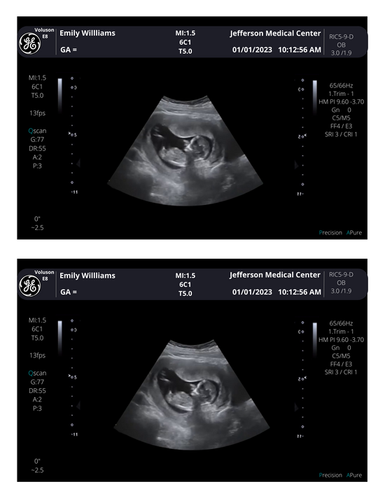 PNG Formats Customizable Digital Ultrasound Downloads | Fake Sonogram ...