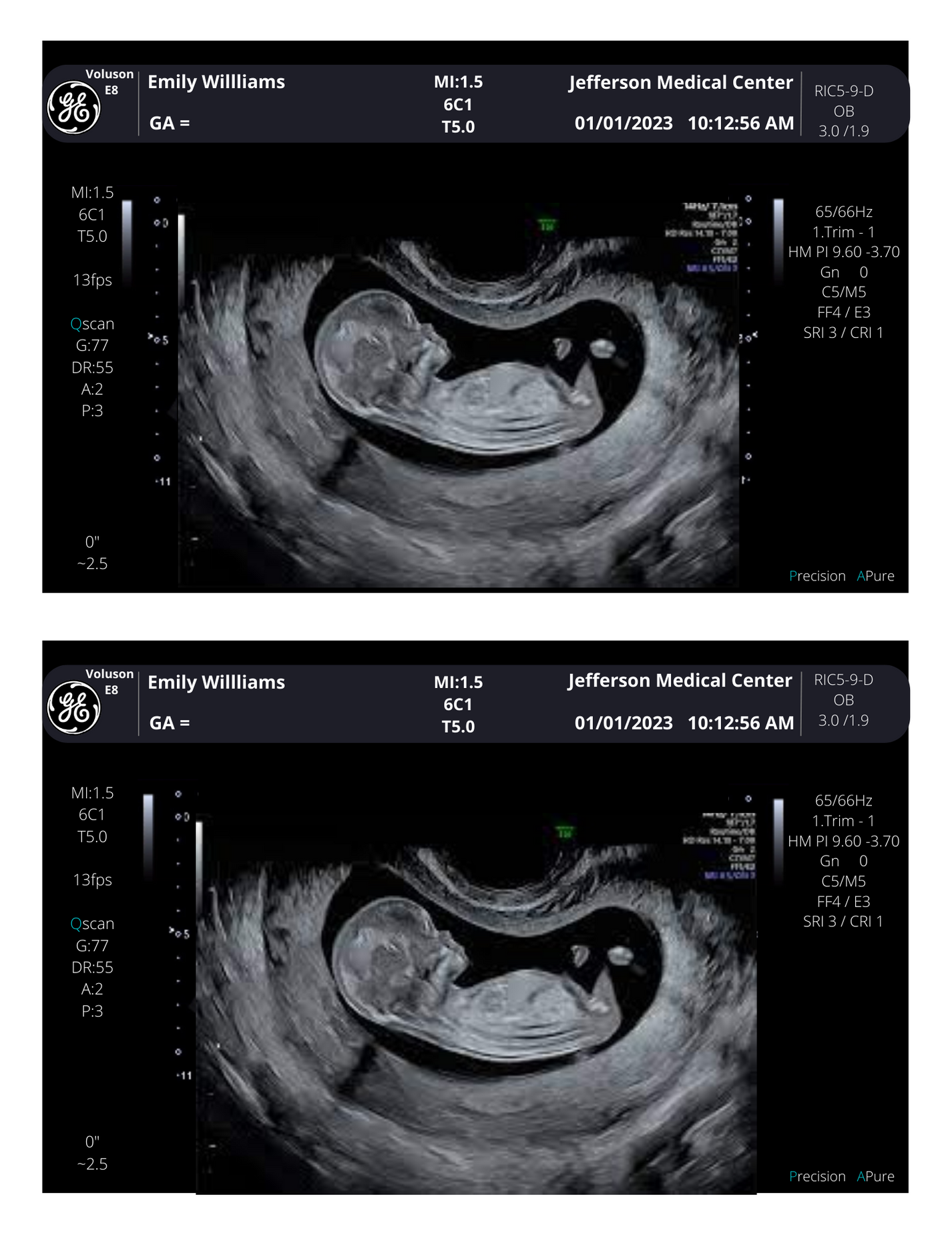 Personalized Fake Ultrasound Sonogram Picture!! From 3-40 weeks! – creetify