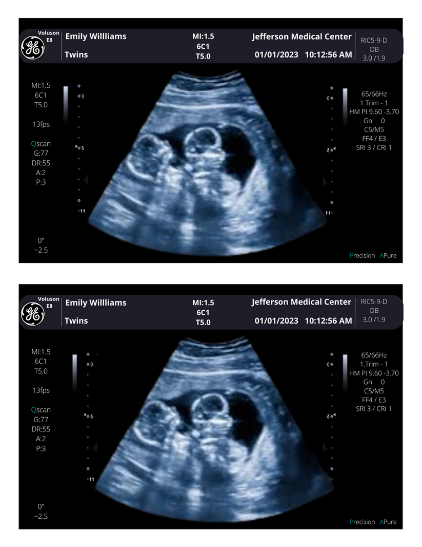 Twins Fake Sonogram Picture!! From 3-40 weeks! | Customizable Digital ...