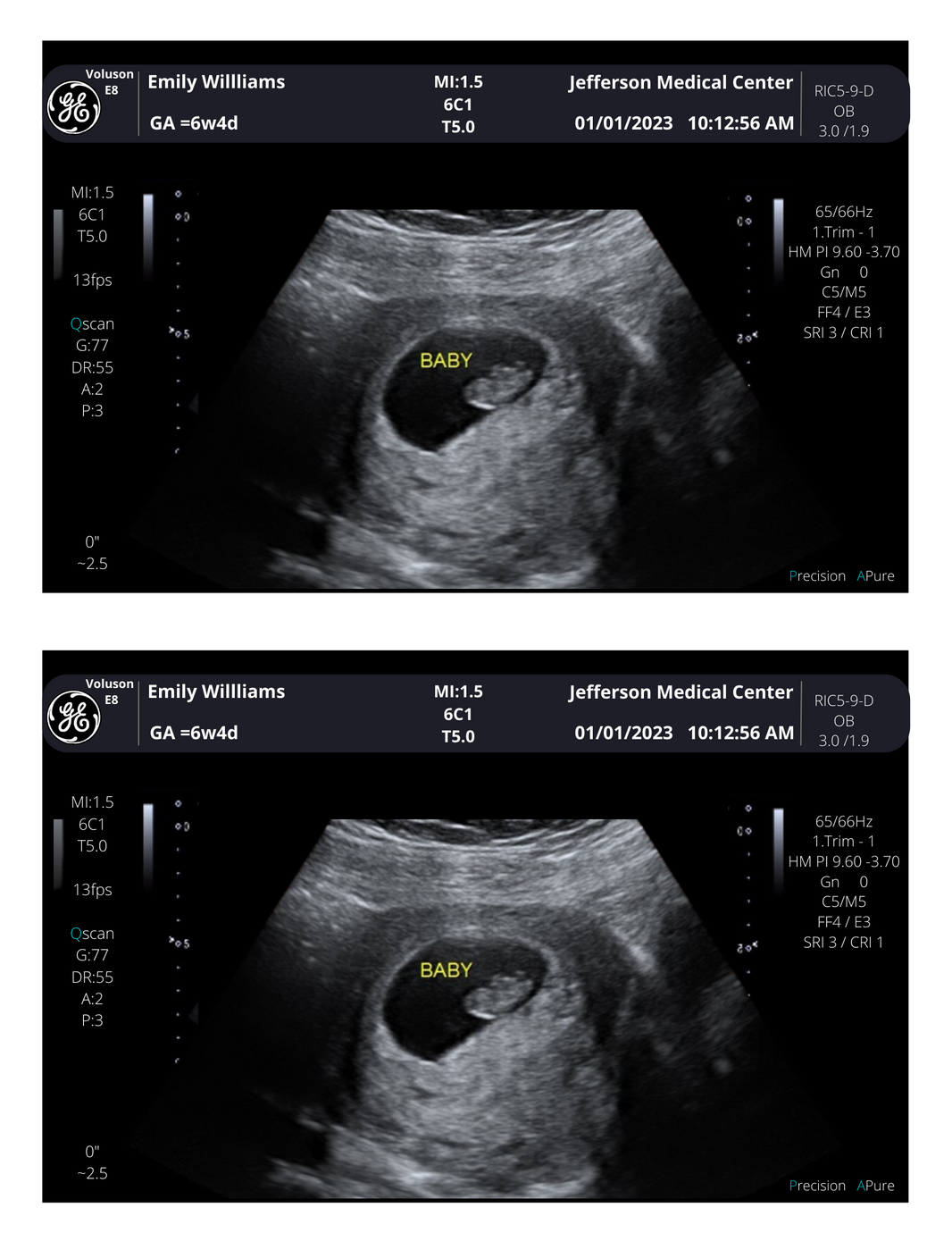 Fake Ultrasound Picture – creetify