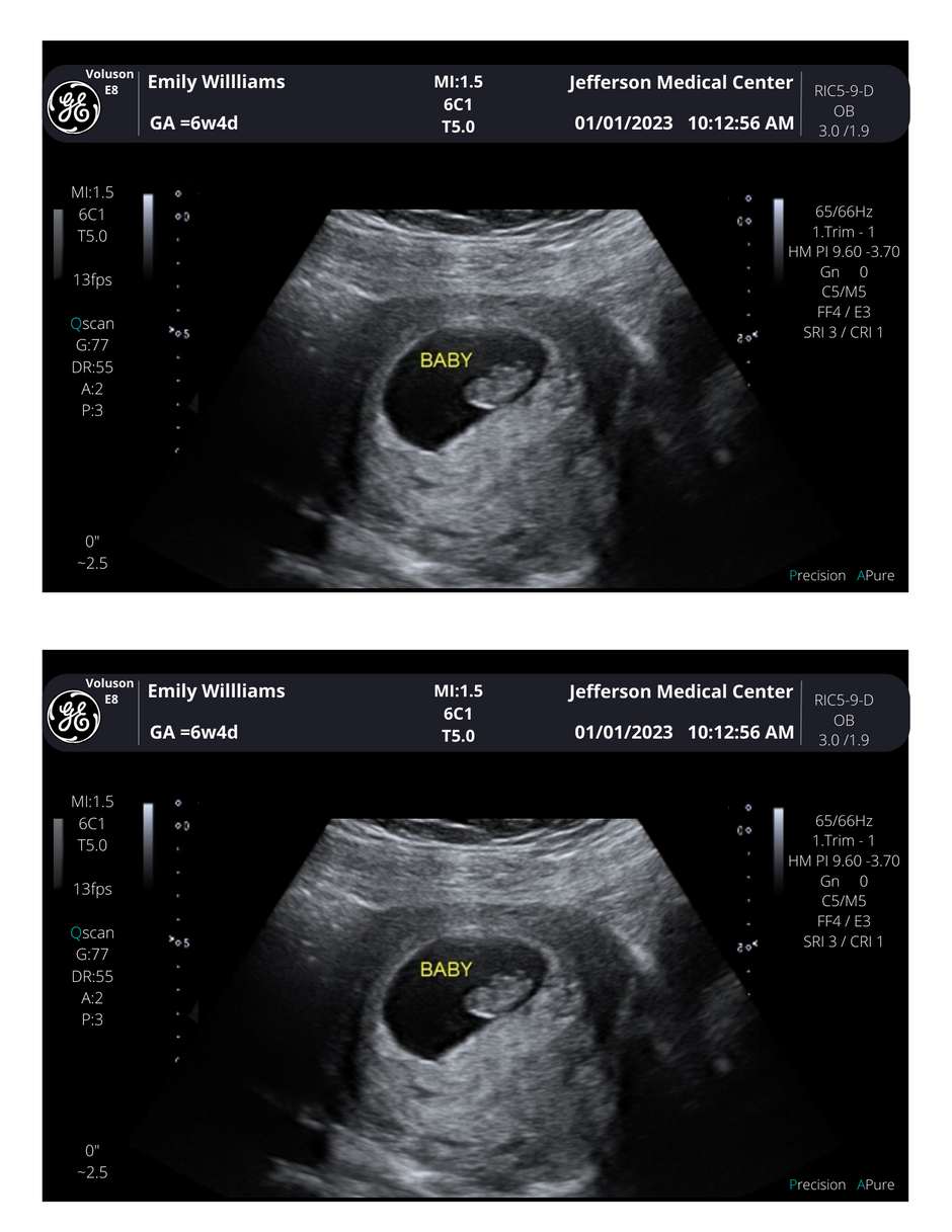 Fake Ultrasound Picture – creetify